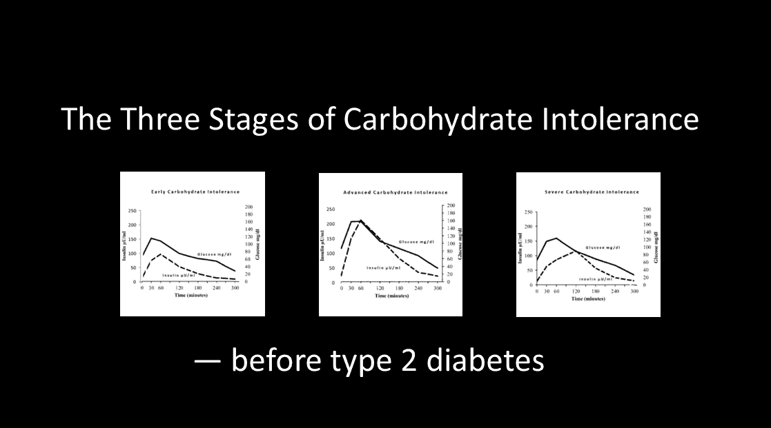 The Three Stages of Carbohydrate Intolerance before Diabetes