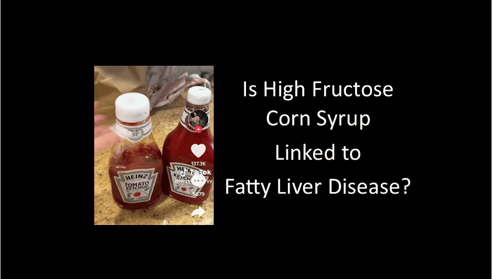 Is High Fructose Corn Syrup (HFCS) Linked to Fatty Liver Disease?